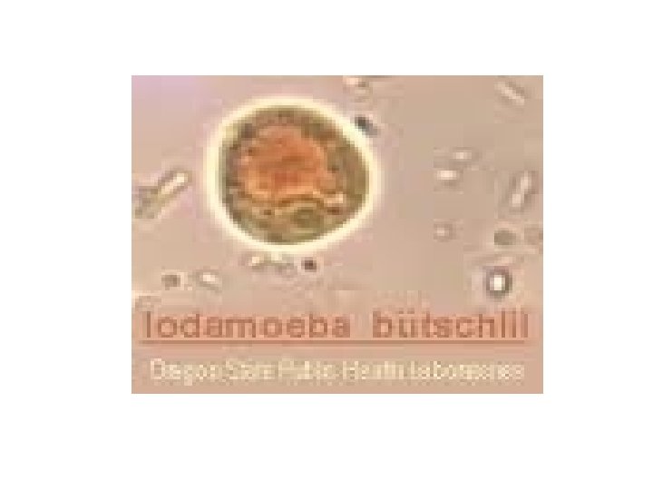 NONPATHOGENIC OPPORTUNISTIC AMOEBAE NONPATHOGENIC AMOEBAE Entamoeba ...