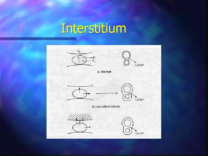 RESTRICTIVE LUNG DISEASE ssharma com By Sat Sharma