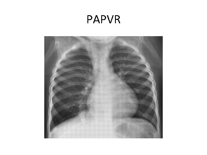 Cardiac Emergencies PALS April 25 2017 Overview Differential