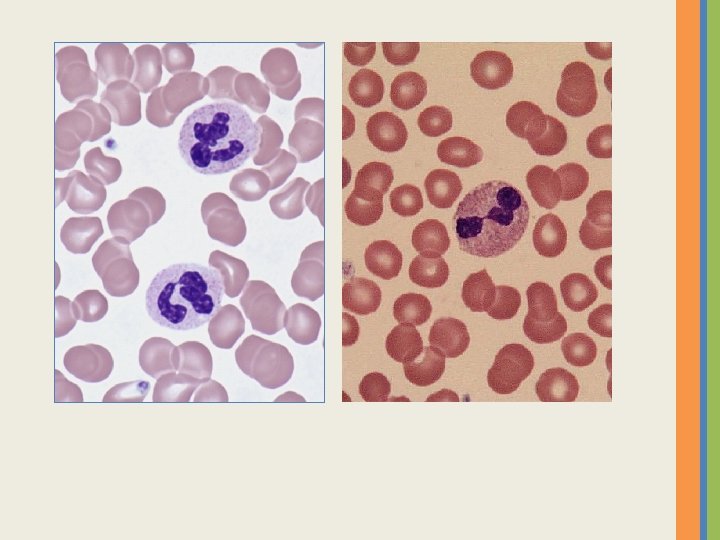 Leukosit Darah Terdiri dari Plasma Sel darah Eritrosit