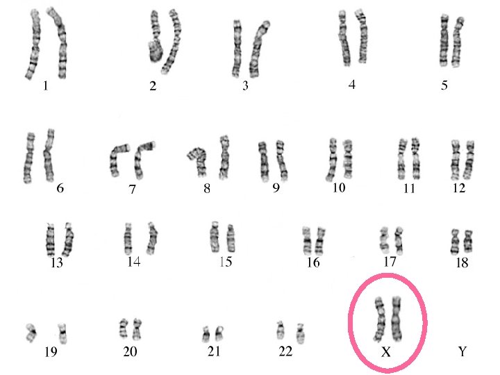Karyotypes Karyotypes Definition A picture of chromosomes cut