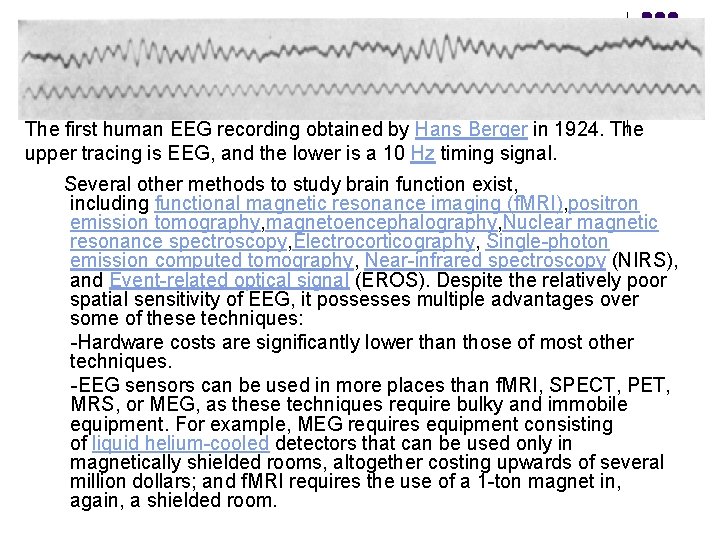 ELECTROENCEPHALOGRAM Electroencephalography EEG is the recording of ...