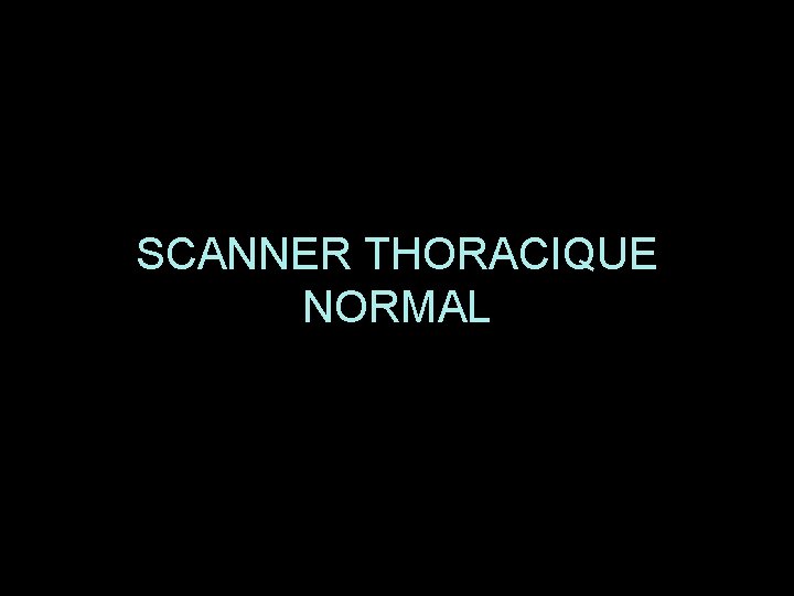 SCANNER THORACIQUE NORMAL Technique Attnuation dun faisceau de