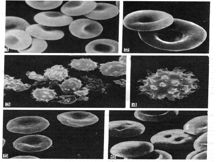 Topic Tissues of internal medium Blood Tissues of