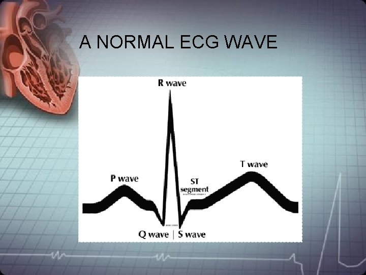 Electrocardiograph History 1842 Italian scientist Carlo Matteucci realizes