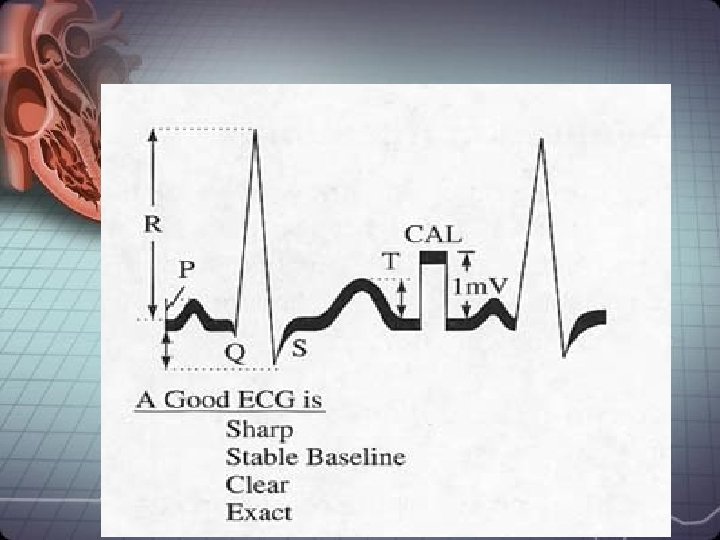 Electrocardiograph History 1842 Italian scientist Carlo Matteucci realizes