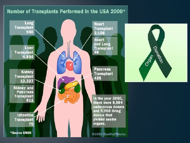 TRANSPLANTOLOGY MARIKA MAZIK WHAT IS ORGAN TRANSPLANTATION TYPES