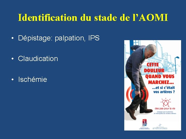 ARTERIOPATHIE OBLITERANTE DES MEMBRES INFERIEURS Pr S Bensalem