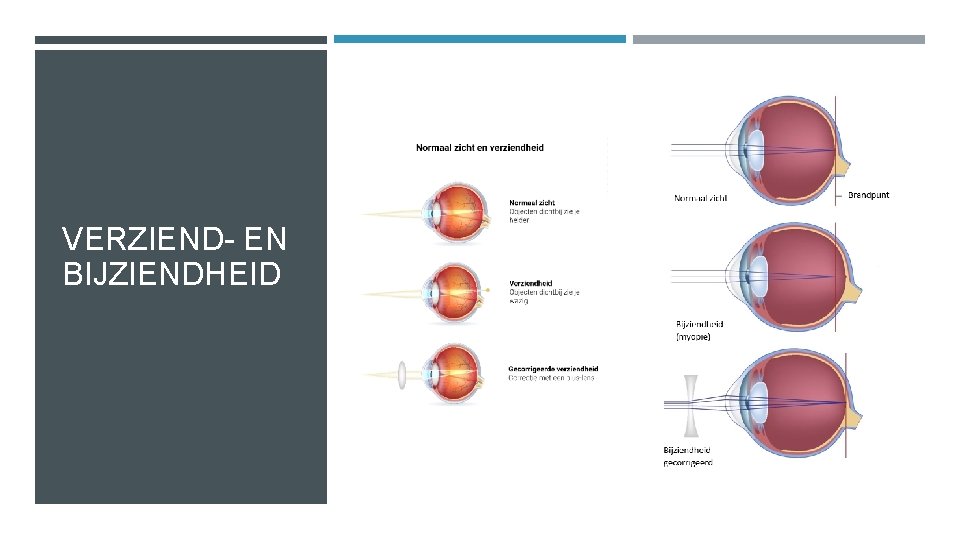 VISUSPROBLEMEN MK 1 LF 2 P 7 REFRACTIEAFWIJKING