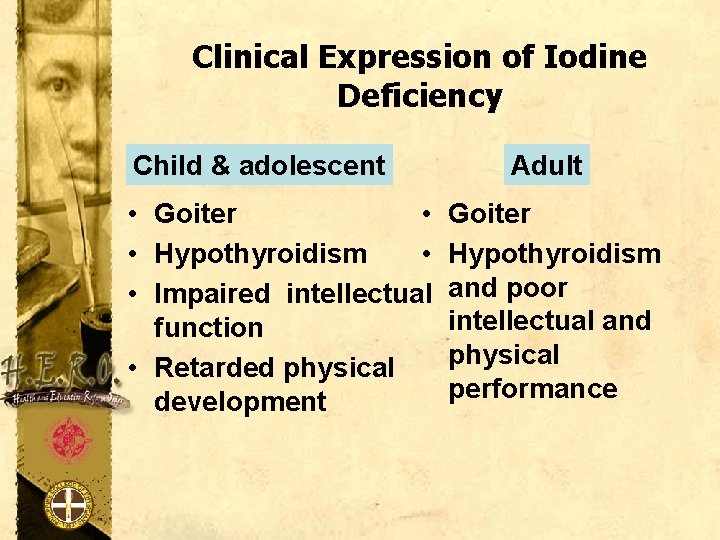 The THYROID GLAND GOITER Ating Alamin Butterflyshaped organ