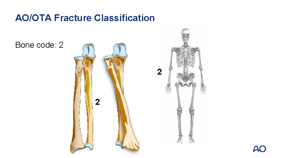 Forearm shaft fractures Volker Braunstein Learning outcomes At