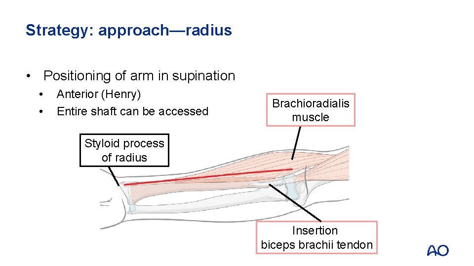 Forearm shaft fractures Volker Braunstein Learning outcomes At