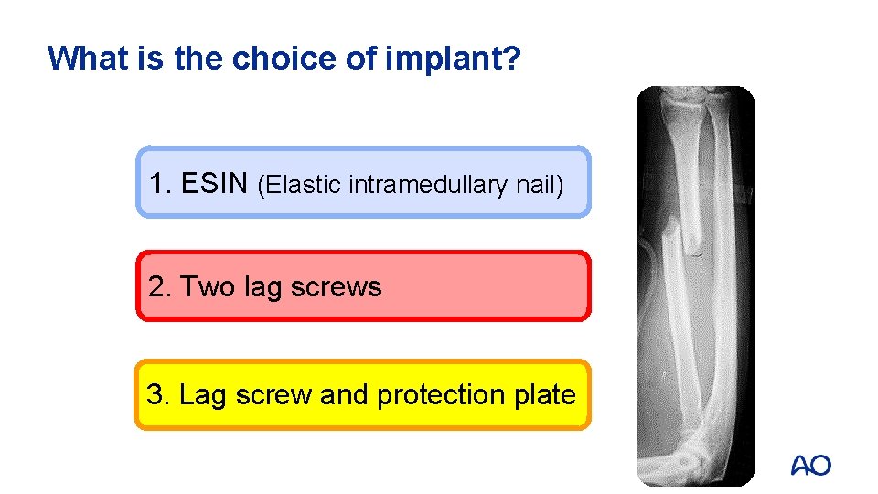 Forearm shaft fractures Volker Braunstein Learning outcomes At