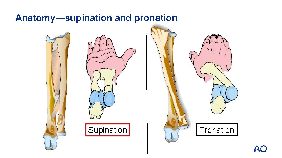 Forearm shaft fractures Volker Braunstein Learning outcomes At