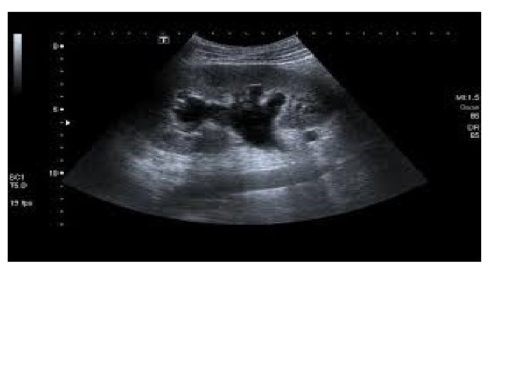 CAT DEVANT UNE COLIQUE NEPHRETIQUE Cas clinique INTRODUCTION