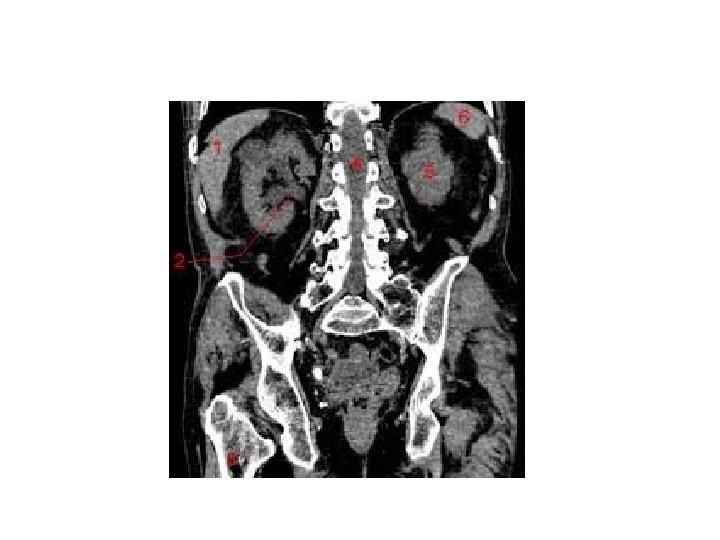 CAT DEVANT UNE COLIQUE NEPHRETIQUE Cas clinique INTRODUCTION