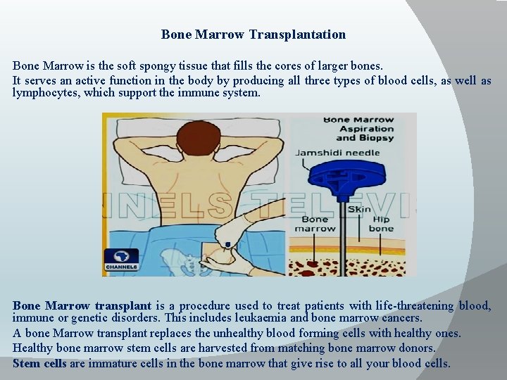 9 BLOOD TRANSFUSION BONE MARROW TRANSPLANTATION Prof Sherif