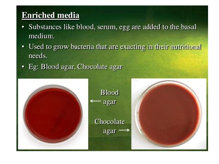 Preparation of bacteriologic media Need for culture media