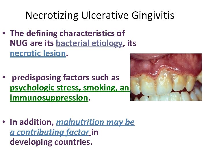 classification of Periodontal Disease LECTURE 8 The classification