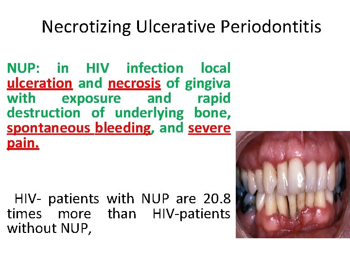classification of Periodontal Disease LECTURE 8 The classification