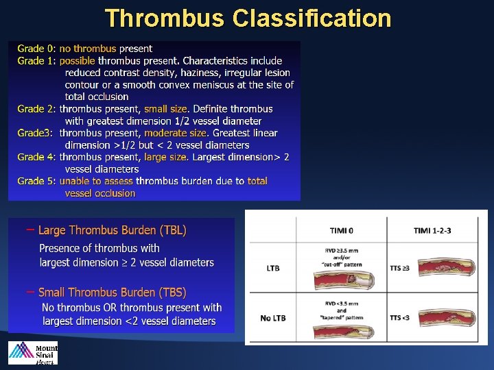 Thrombus management in the catheterization lab pharmacological options