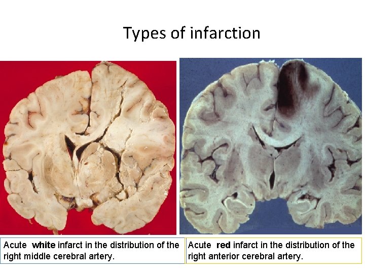 Cerebrovascular Diseases 1 Pathophysiological Facts For maintained normal