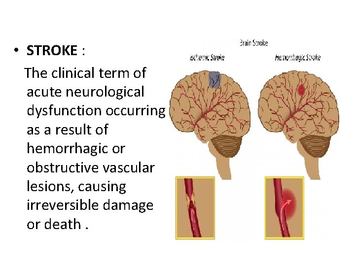 Cerebrovascular Diseases 1 Pathophysiological Facts For maintained normal