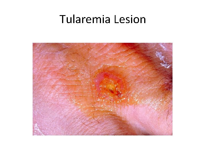 Diagnostic microbiology lecture 14 MYCOBACTERIA Abed El Kader