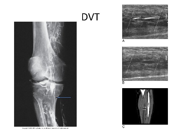 Lymphography and Venography 2012 Venous Circulation What is