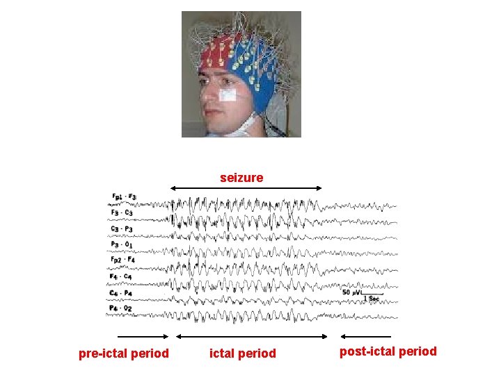 Can brains generate random numbers joint work with