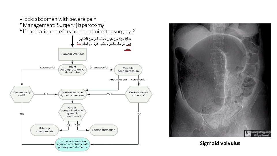 Abscess Management Open DrainNOT antibiotics Antibiotics after primary