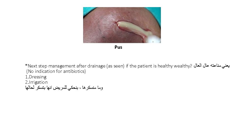 Abscess Management Open DrainNOT antibiotics Antibiotics after primary