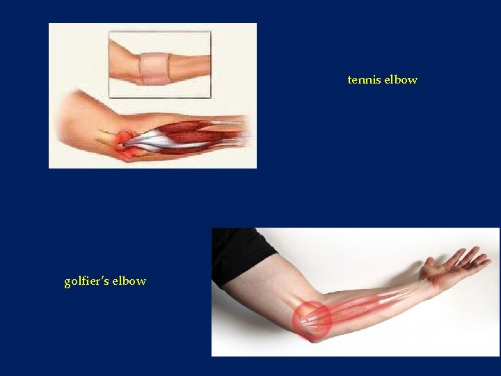 Elbow joint articulatio cubiti Dr Anna L Kiss