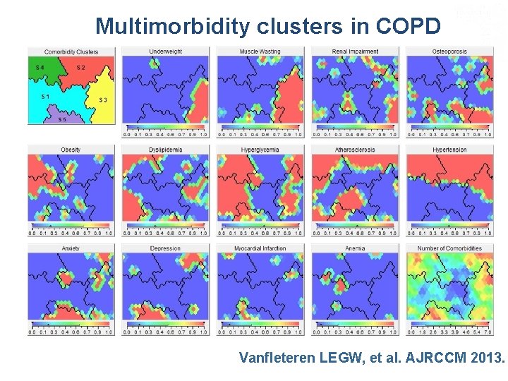 Infradiagnstico en EPOC cmo podemos mejorarlo Joan B