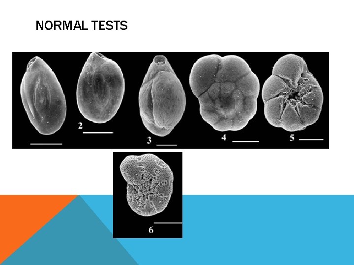 FORAMINIFERA CAN BE USED AS ECOLOGICAL INDICATORS 1