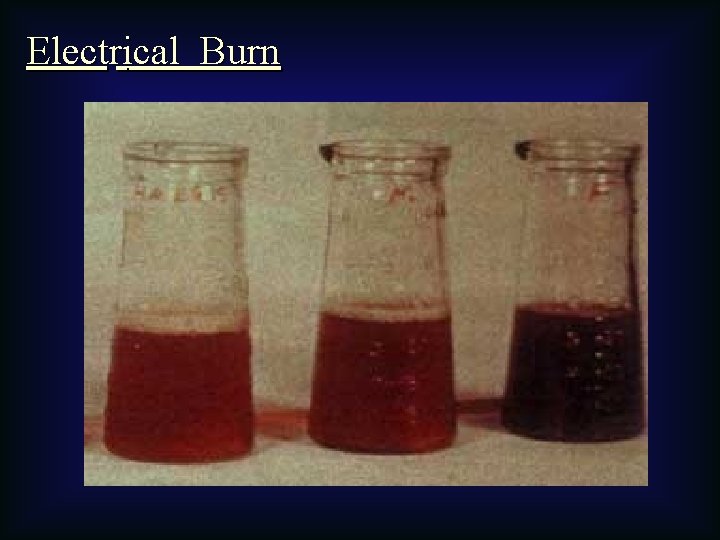 First Aids and Prevention Tarek Abulezz Sohag University