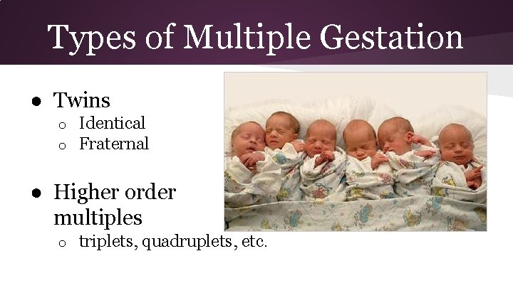 Multiple Gestation Brooke Bracy JB Kagabo Danielle Loomis