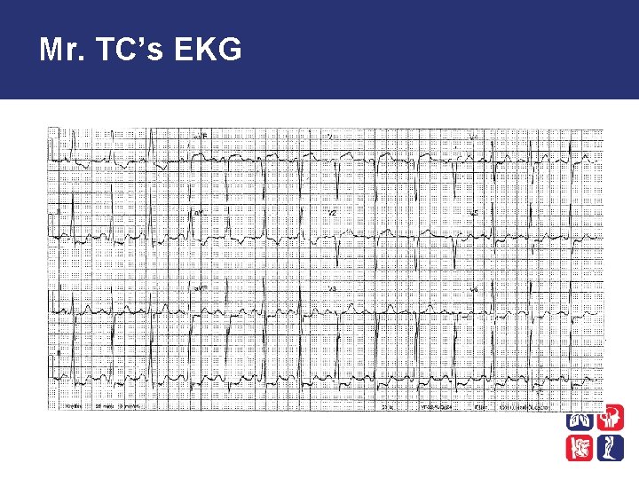 Acute Coronary Syndrome In Hospital Antiplatelet Management Disclosures