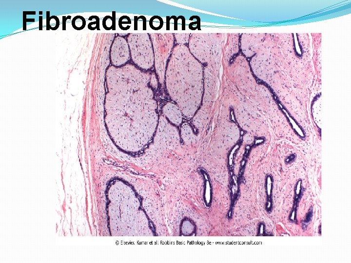 Pathology of The Breast Lesions of female breast