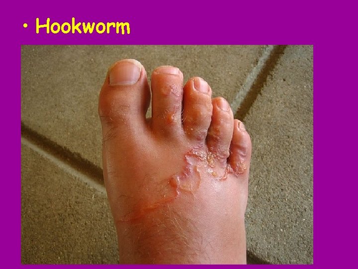 WORMS 1 Part One Unsegmented Worms Their bodies