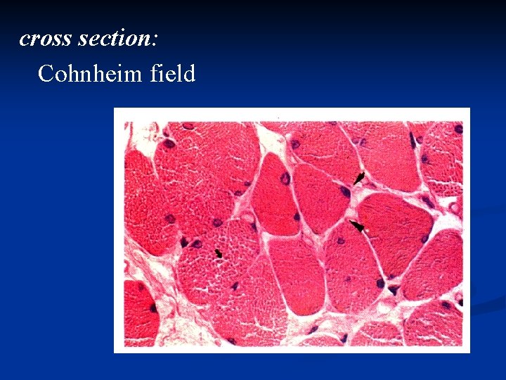 Chapter 6 muscle tissue introduction Composition muscle cellloose