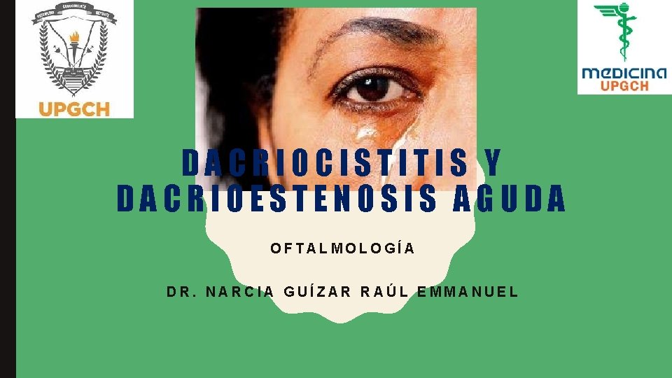 DACRIOCISTITIS Y DACRIOESTENOSIS AGUDA OFTALMOLOGA DR NARCIA GUZAR