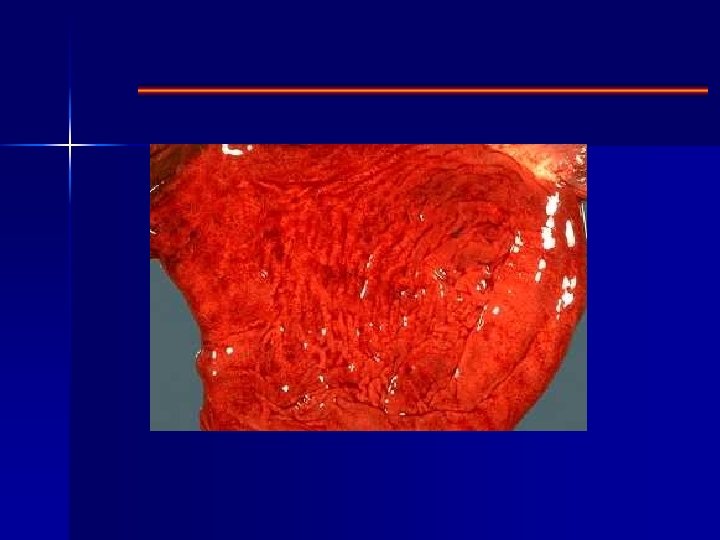 Pathology of the Stomach Objectives and aim To