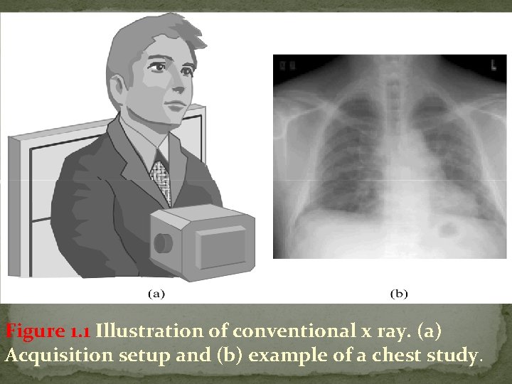 CT Basics Introduction The word tomography is derived