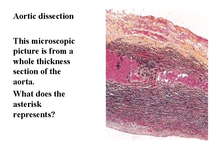 Cardiovascular System Pathology Lab 3 rd year medical