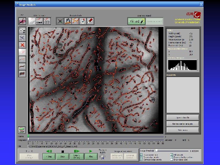 La microcirculacin en la sepsis Arnaldo Dubin Ctedra