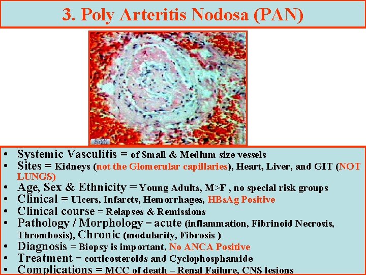 Blood Vessels Pathology Congenital Anomalies Arteriosclerosis HTN ...