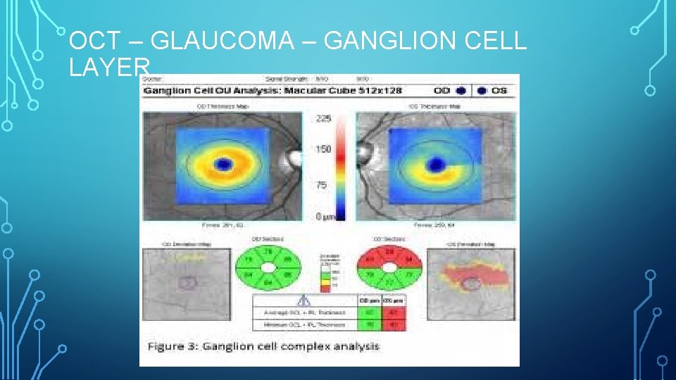 WHATS NEW TECHNOLOGIES IN OPTOMETRIC MANAGEMENT OF EYE