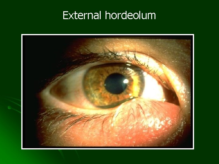 Disorders of the Eye Chapter 9 Medical Considerations