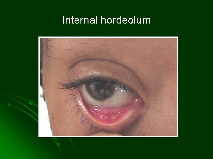 Disorders of the Eye Chapter 9 Medical Considerations